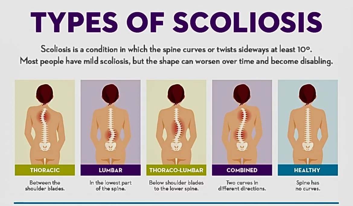 Lower Back Pain – Laux Clinic of Chiropractic Medicine